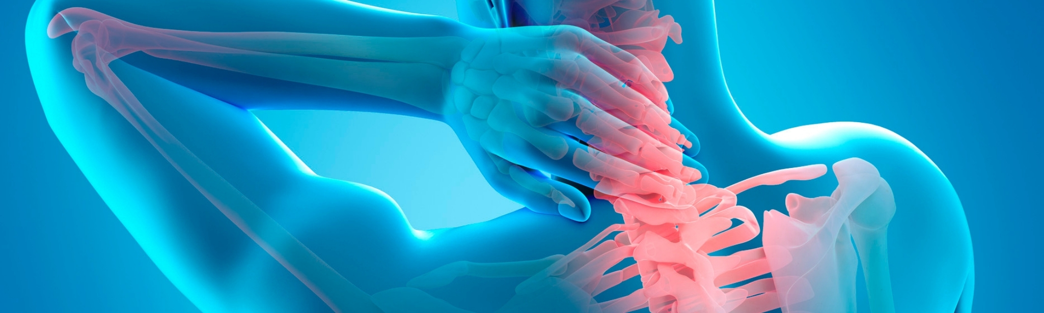 Neck Sprains and Strains | TORKLAW